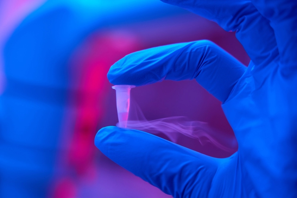 Prélèvement transabdominal d'ovocytes à Los Angeles pour les patientes ...