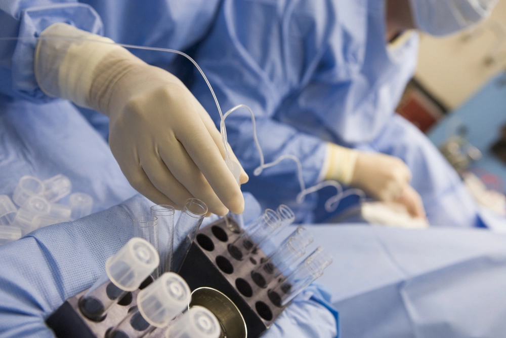 Prélèvement transabdominal d'ovocytes à Los Angeles pour les patientes ...